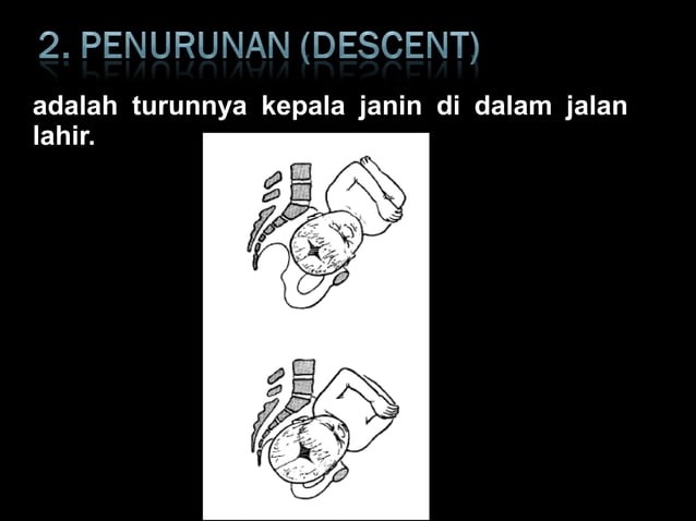 Mekanisme Persalinan Normal | PPTX