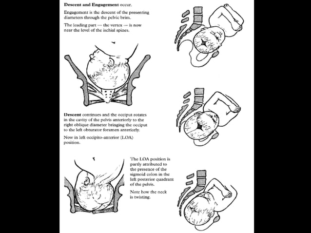 Mekanisme Persalinan Normal | PPTX