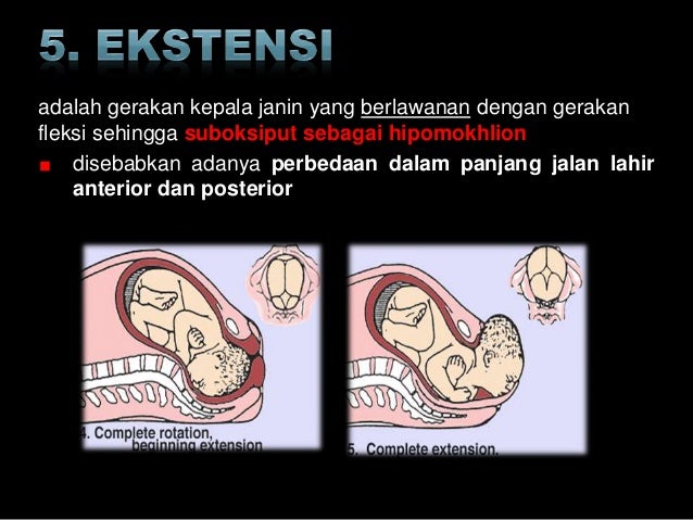 Mekanisme Persalinan Normal