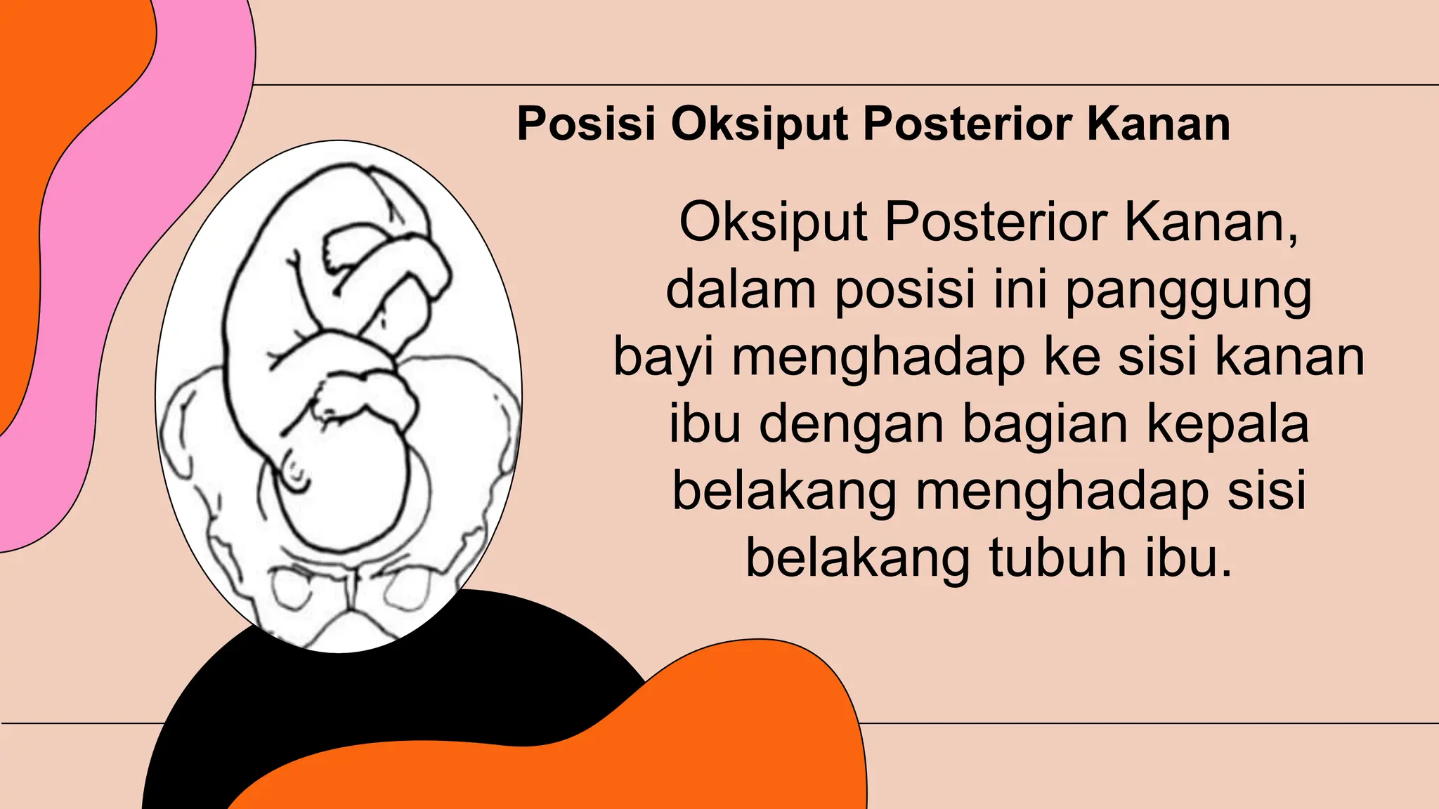 Mekanisme Persalinan Presentasi Oksiput Posteroir (1).pptx