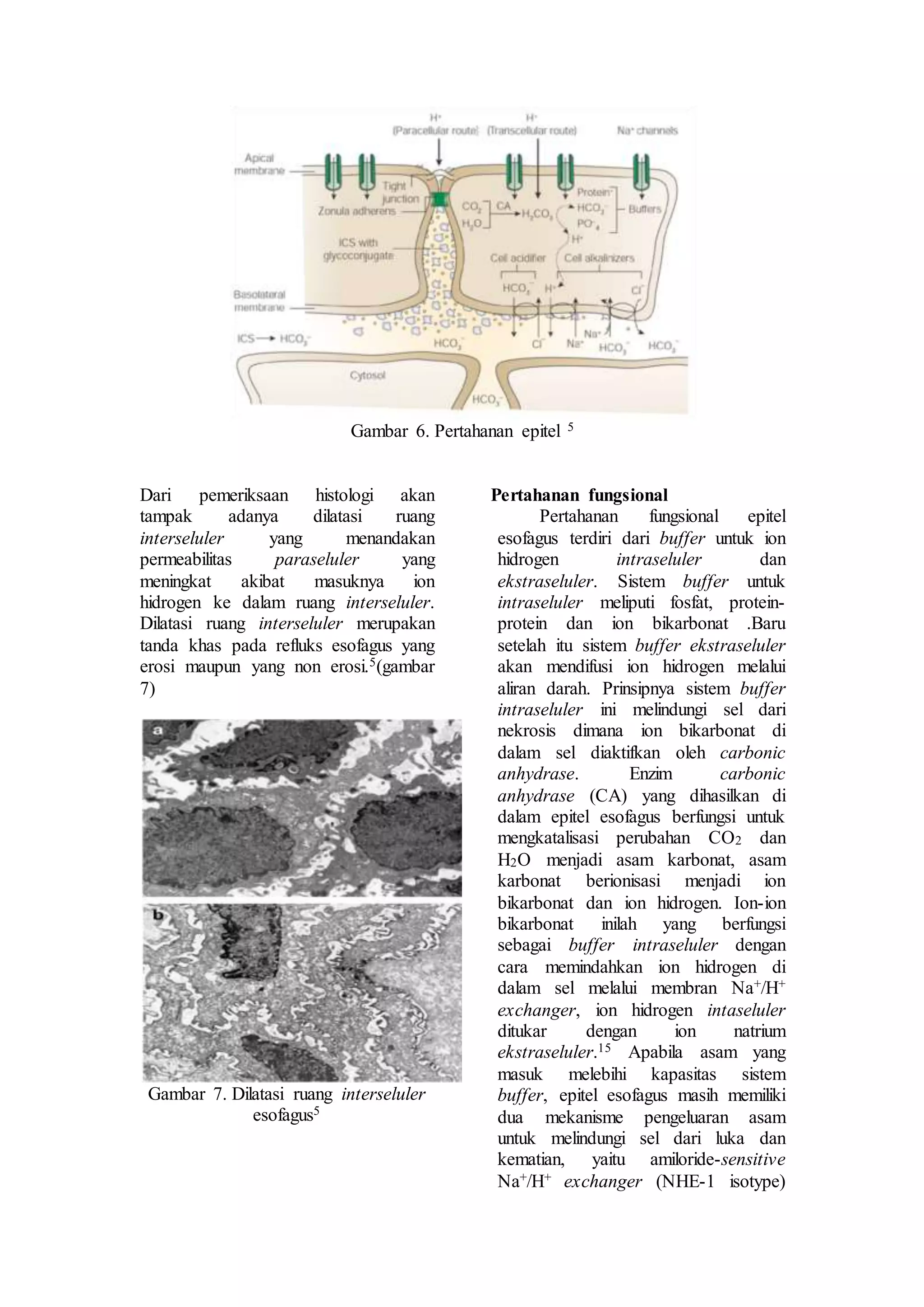 Mekanisme pertahanan mukosa esofagus jurnal tht kl | DOCX
