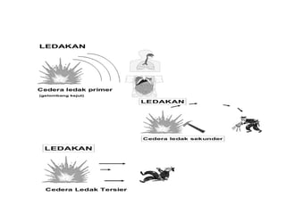 Mekanisme Trauma dalam kegawatdaruratan.ppt
