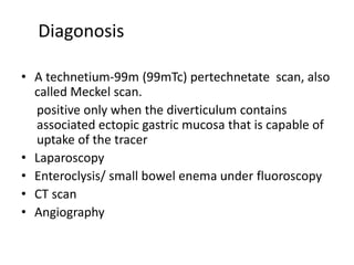 Mekel’s diverticulum | PPTX