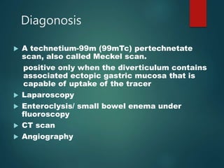Mekelsdiverticulum. | PPT