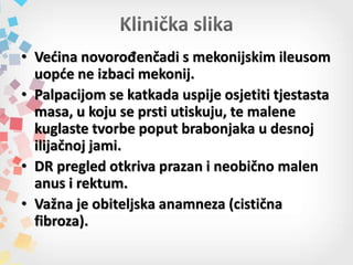 Mekonijski ileus | PPT