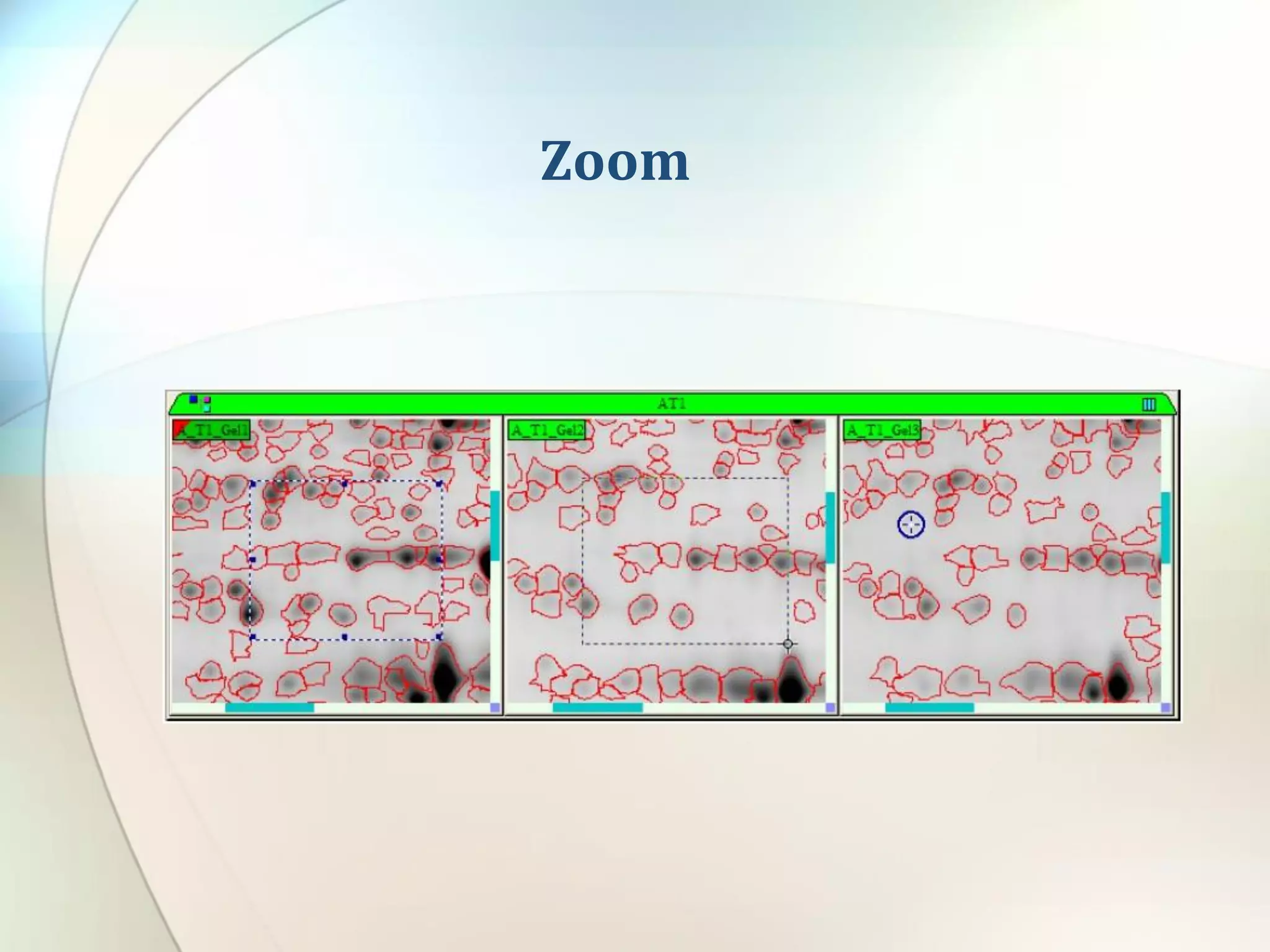 Melanie - 2D gel analysis software | PDF
