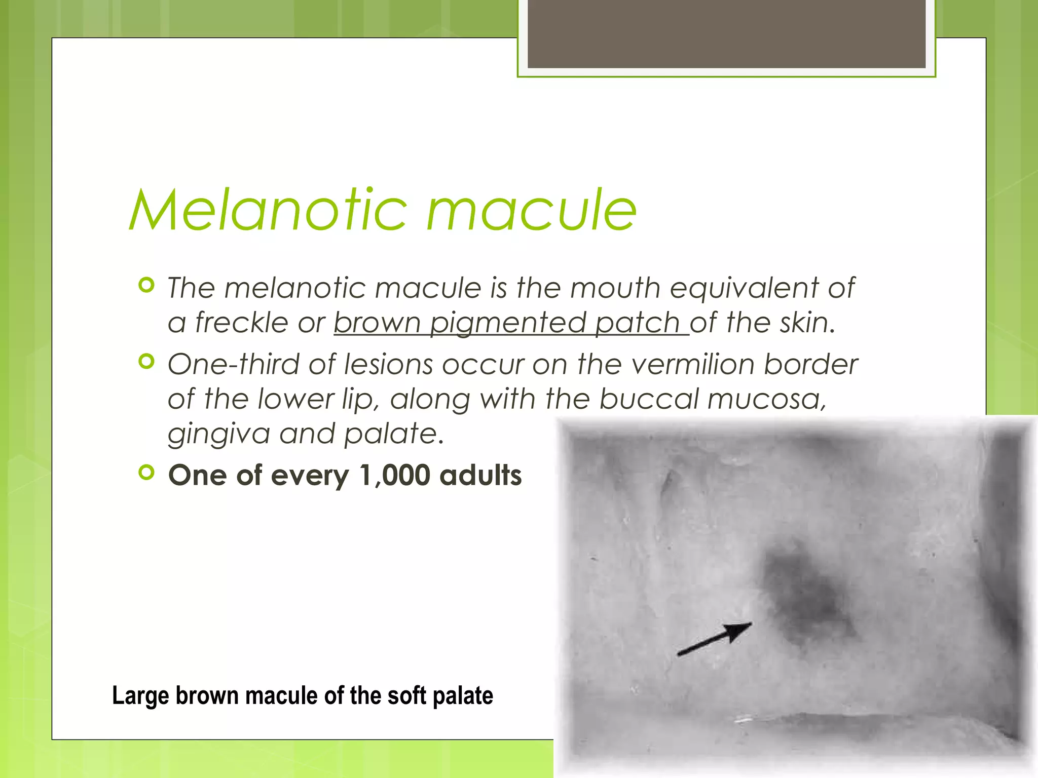 Melanin synthesis | PPT