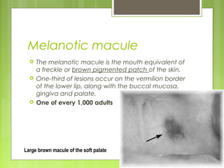Melanin synthesis | PPT