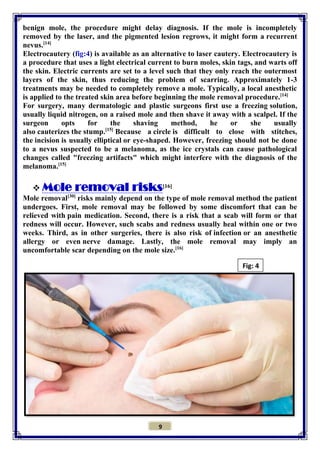 Melanocytes' tumors 2018 | PDF