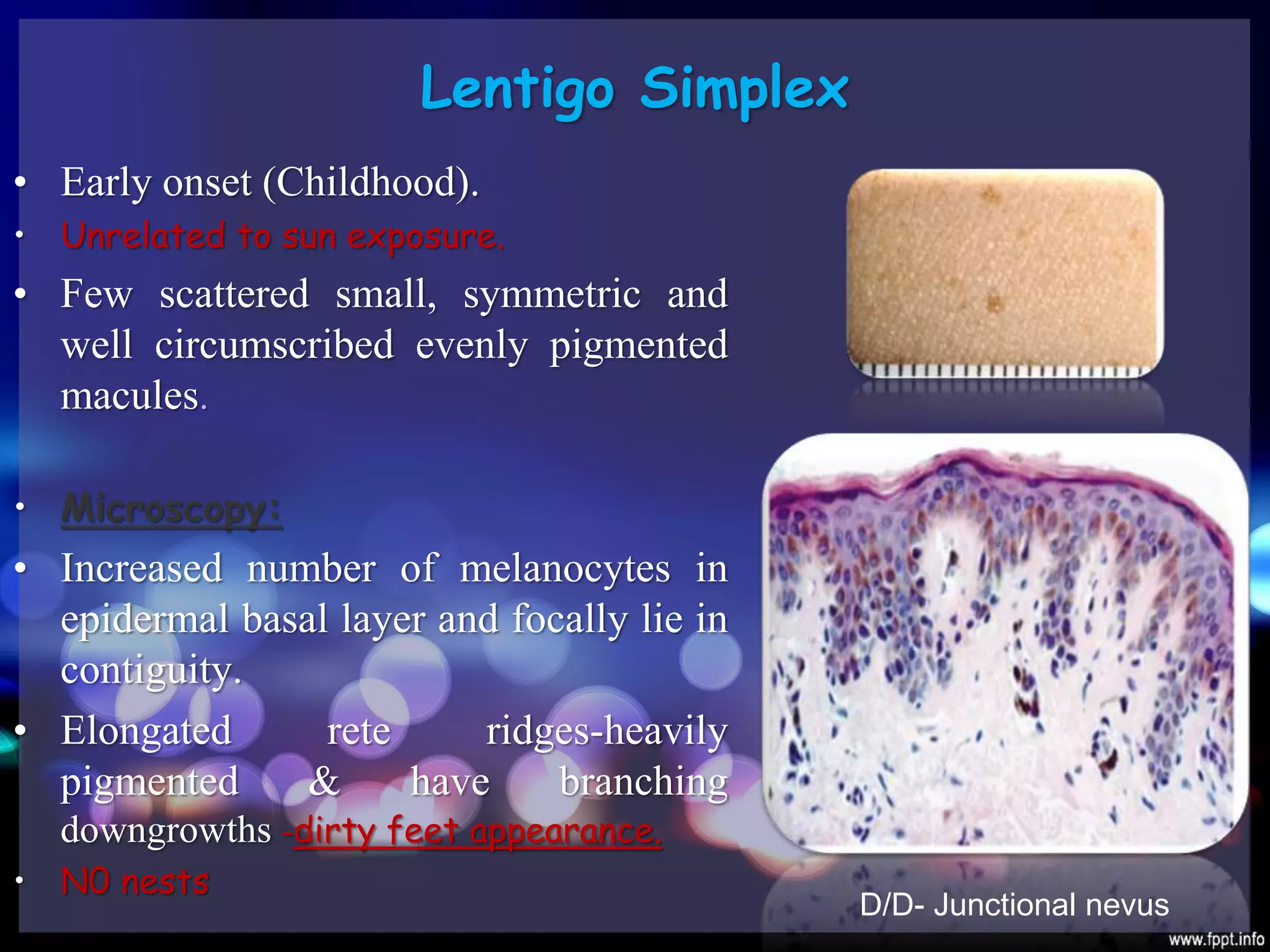 Melanocytic lesion of skin ( final) | PPTX
