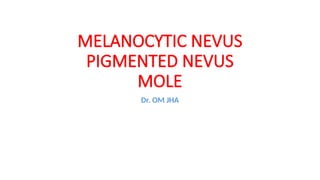 Congenital nevus Melonocytic nevus Birth marks | PPTX