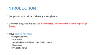 Congenital nevus Melonocytic nevus Birth marks | PPTX