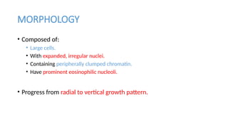 Congenital nevus Melonocytic nevus Birth marks | PPTX