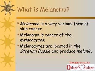 Melanoma | PPT