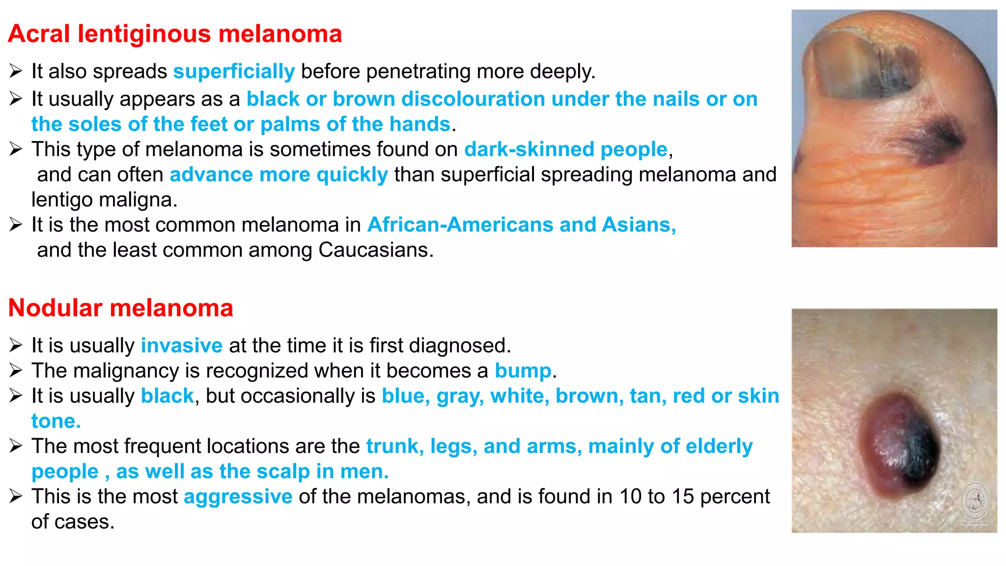 melanoma-141202123441-conversion-gate01.pdf