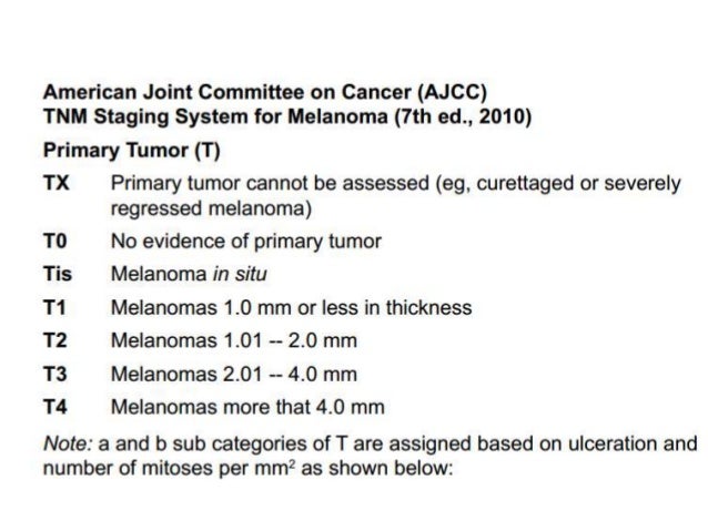 Malignant Melanoma Stages