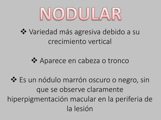 Cáncer de piel: Melanoma | PPTX