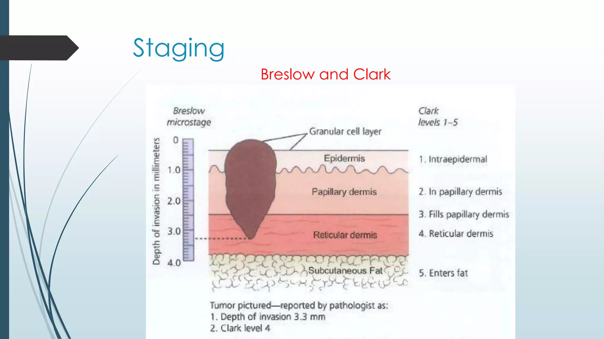 Melanoma | PDF | Skin and Dermatology | Diseases and Conditions