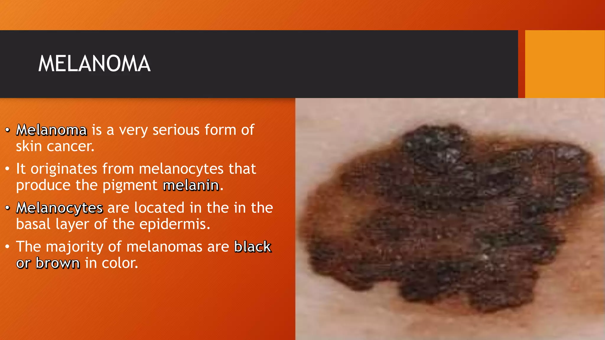 Melanoma.pptx