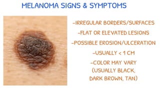 Melanoma.pptx