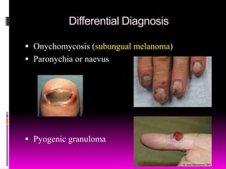 Melanoma Made VERY Easy!! | PPTX