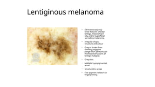 malignant melanoma and dermoscopic .pptx
