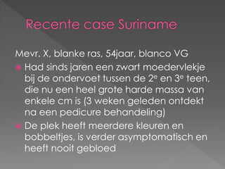 Melanoma derma | PDF