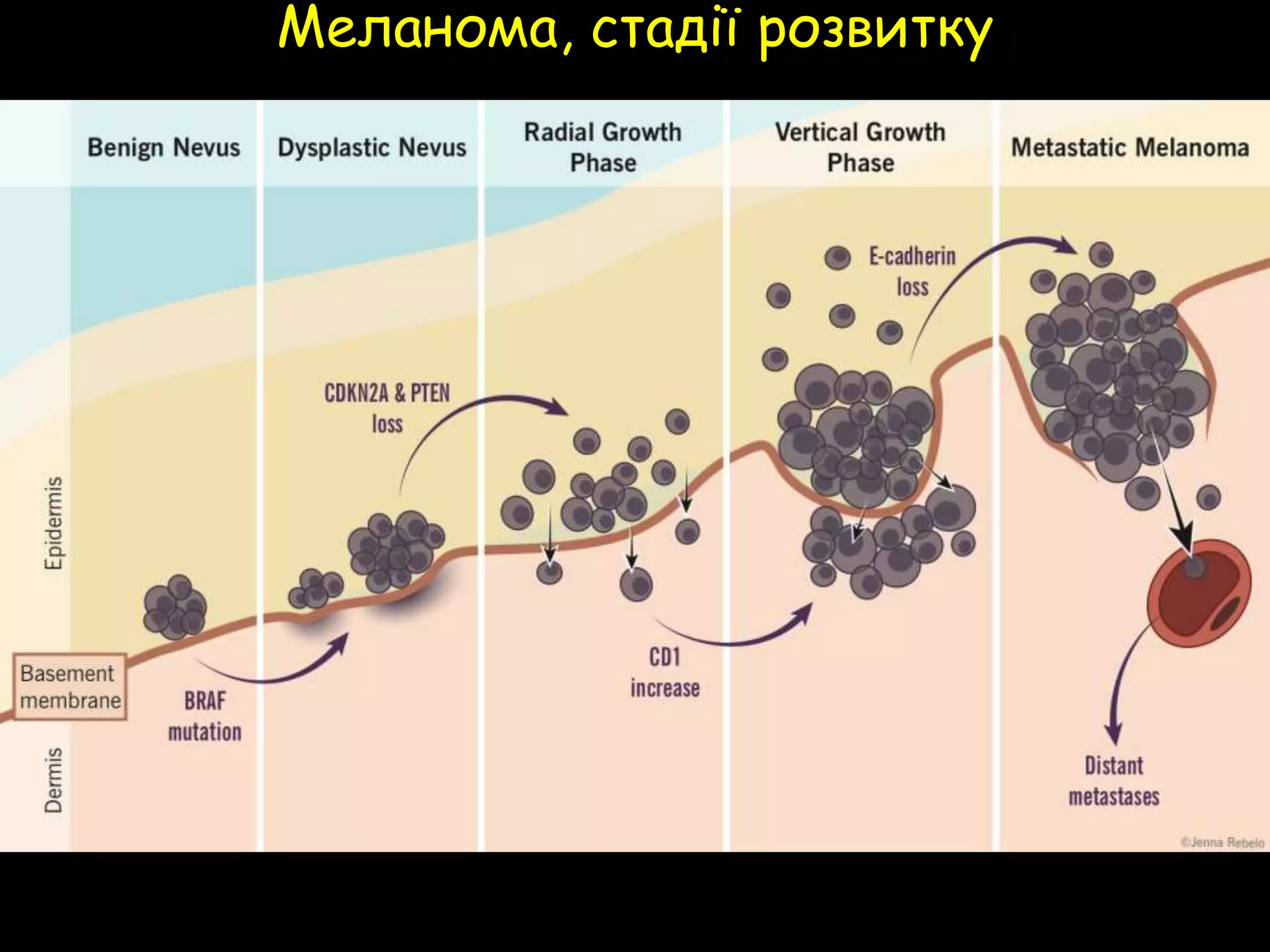 Melanoma kdd 2019 | PPT