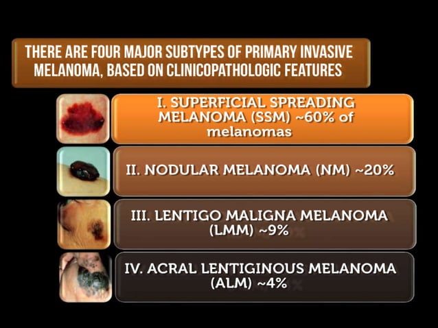 Melanoma and melanoma types with treatment | PPTX | Skin and ...