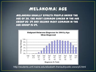 Melanoma (skin cancer) | PPTX