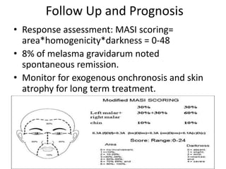 Comprehensive overview of melasma | PPTX
