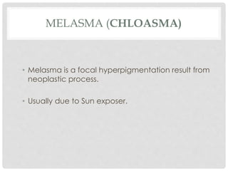 Melasma | PPTX