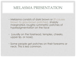 Melasma | PPTX