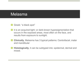 Melasma | PPT