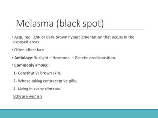 Melasma | PPTX