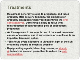 Melasma | PPTX