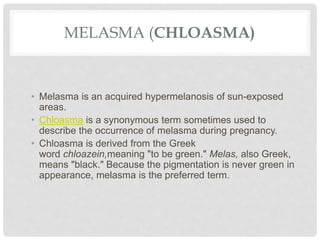 Melasma 14.03.2016 ben | PPTX