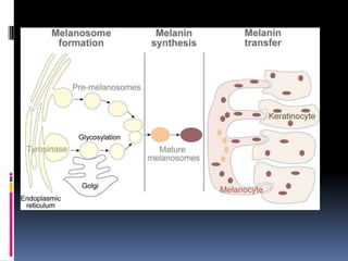 Melasma – epidemiology, classification - Prof. Torello Lotti, MD | PPTX ...