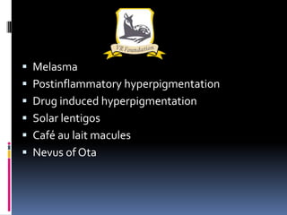Melasma – epidemiology, classification - Prof. Torello Lotti, MD | PPTX ...