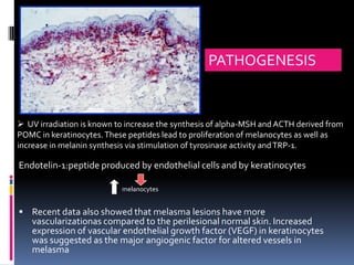 Melasma – epidemiology, classification - Prof. Torello Lotti, MD | PPTX ...