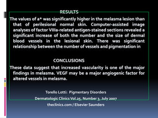 Melasma – epidemiology, classification - Prof. Torello Lotti, MD | PPTX ...