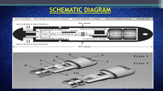 Melectronic pill | PPT