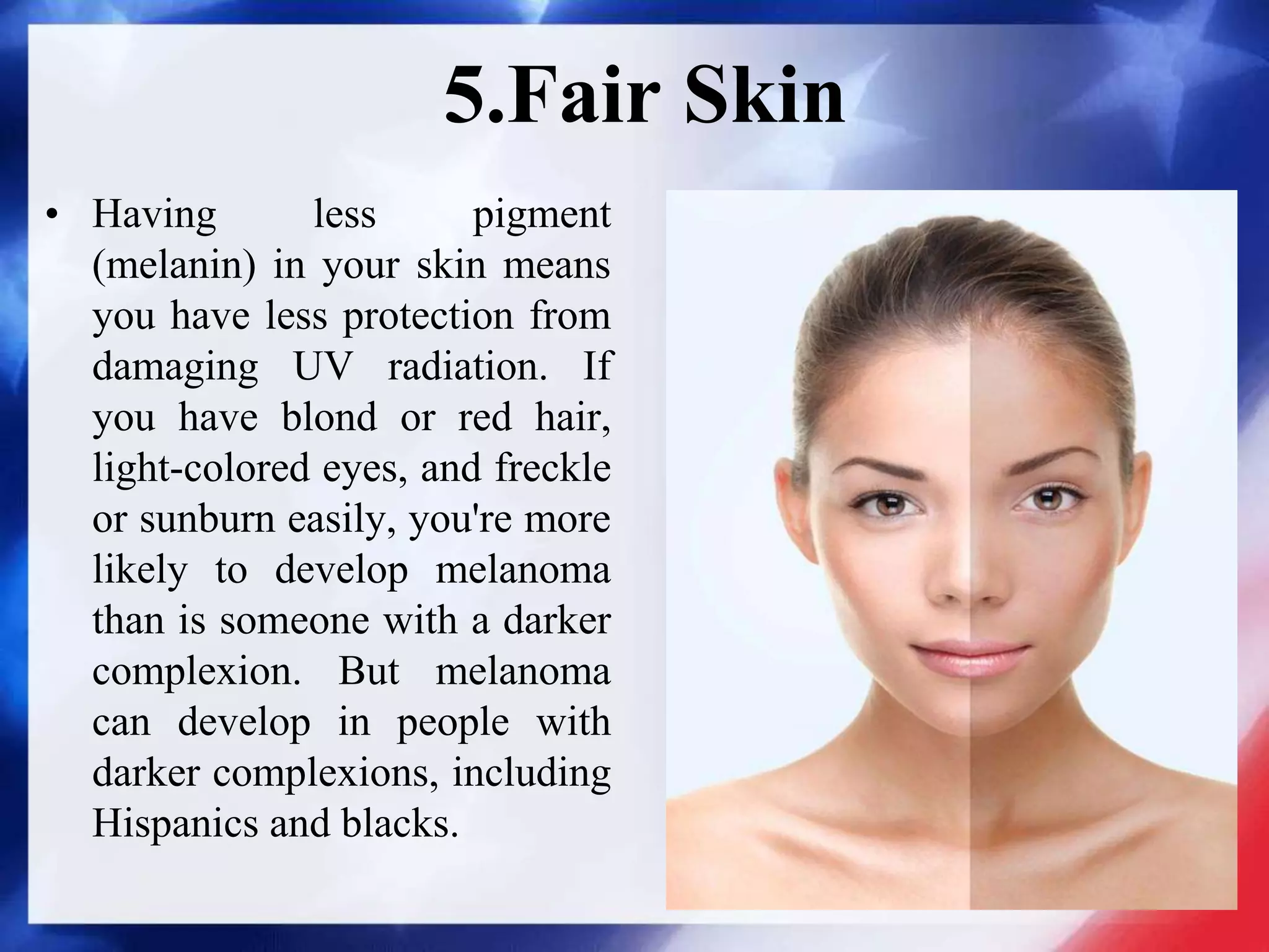 Malignant melanoma Presented by Mo. Haroon Rashid | PPTX