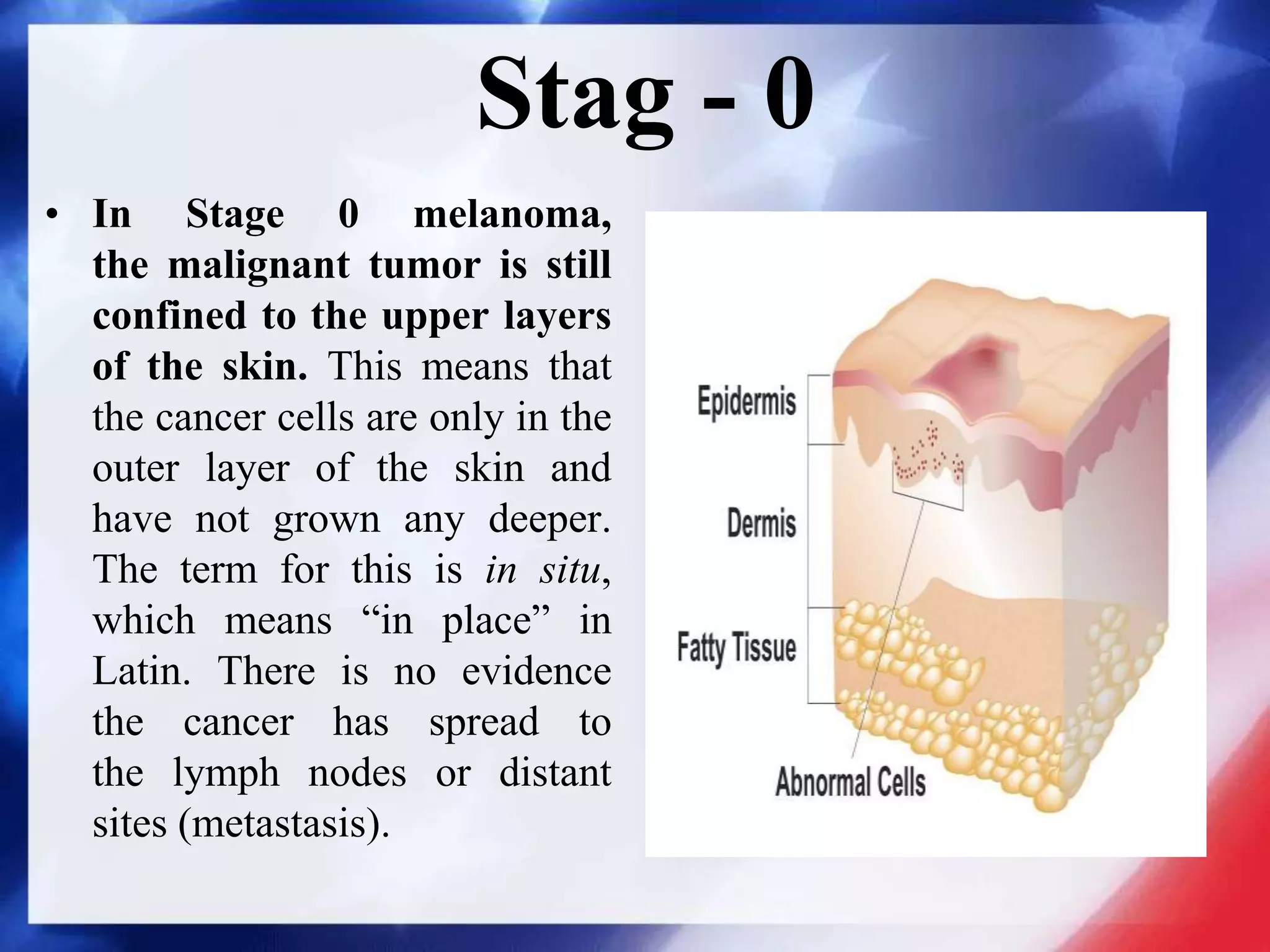 Malignant melanoma Presented by Mo. Haroon Rashid | PPTX