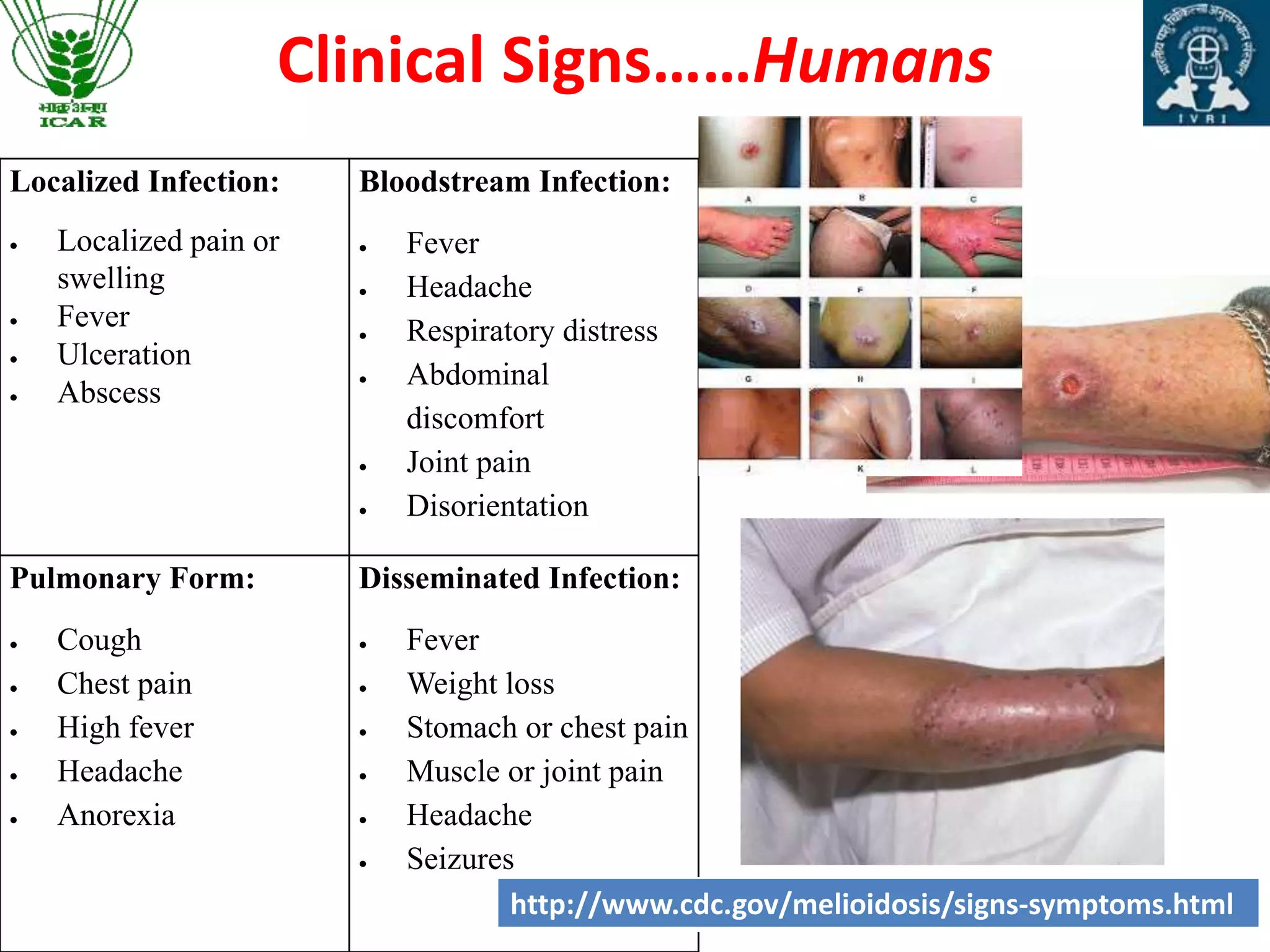 Melioidosis an overview | PPTX