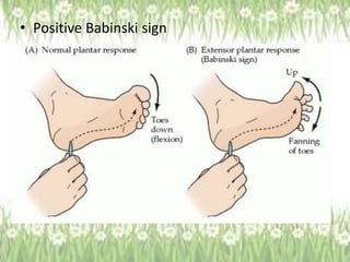 MELLSS yr1 physiology paralysis | PPT
