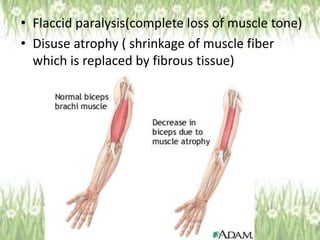 MELLSS yr1 physiology paralysis | PPT