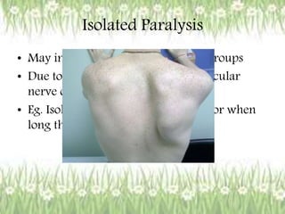 MELLSS yr1 physiology paralysis | PPT