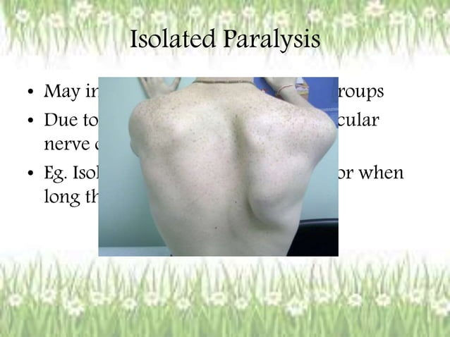 MELLSS yr1 physiology paralysis | PPT