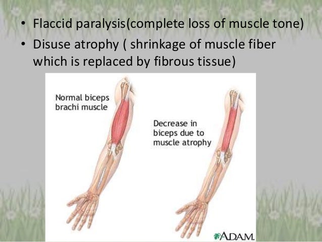 MELLSS yr1 physiology paralysis